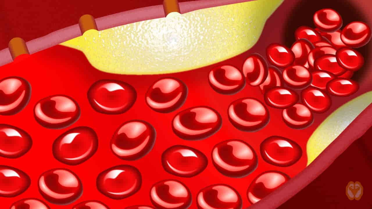 Triglycerides Meaning In Telugu Test Benefits